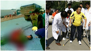 Relembre o caso de Peng Shuilin: homem sobrevive com metade do corpo ...